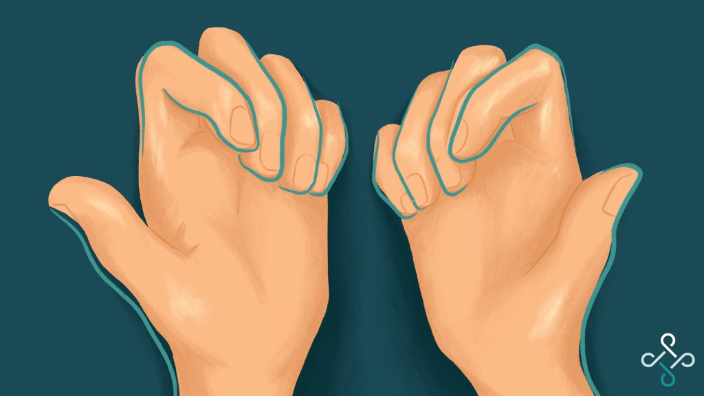 Spotlight on Scleroderma – Autoimmune Connect